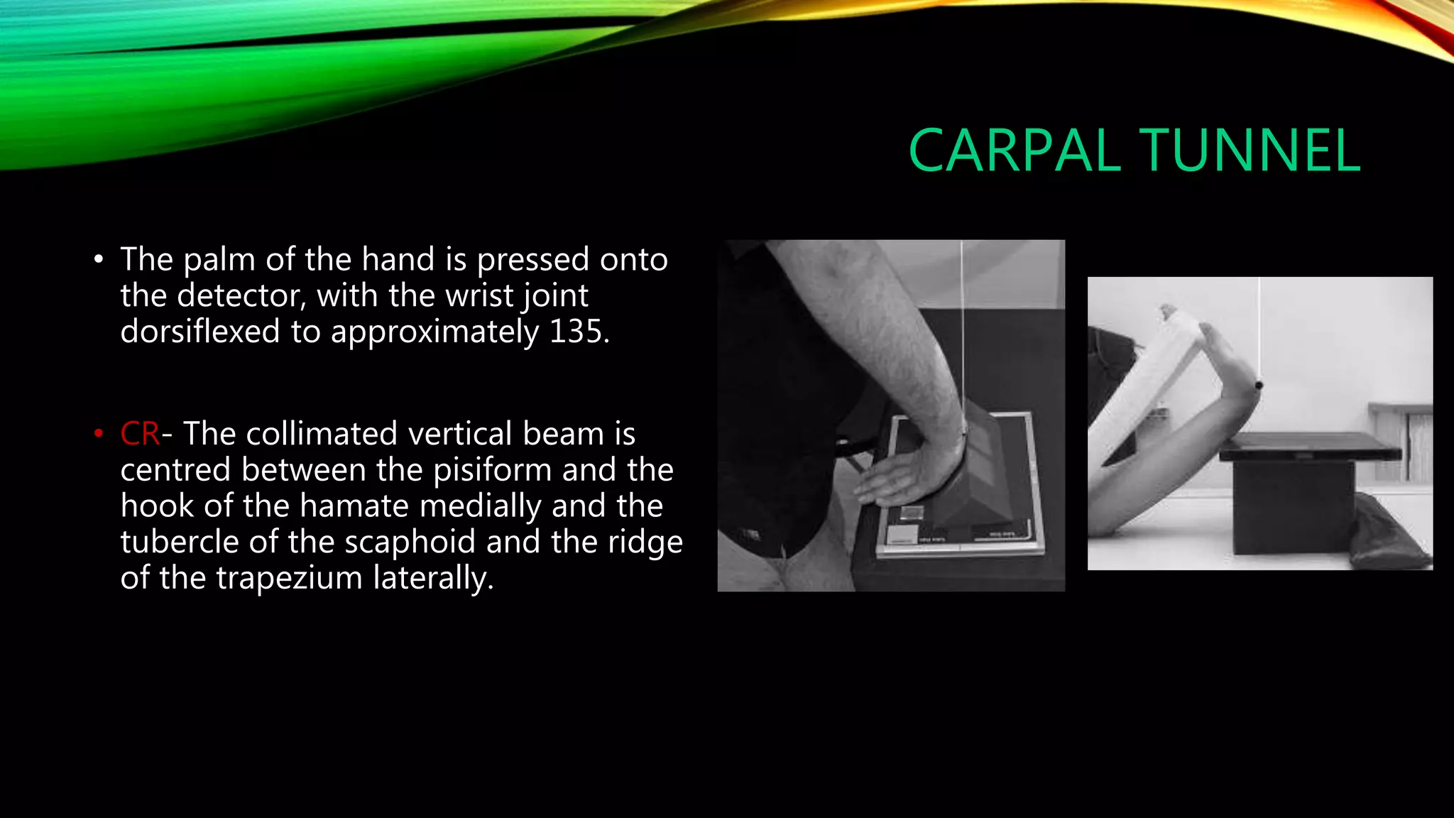 X ray of wrist and hand | PPTX