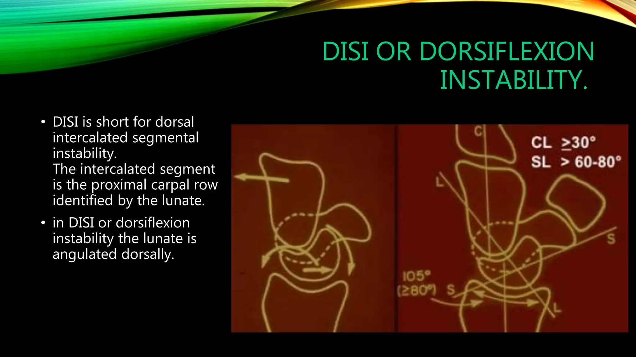 X ray of wrist and hand | PPTX