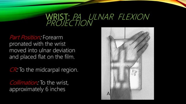 X ray of wrist and hand | PPTX