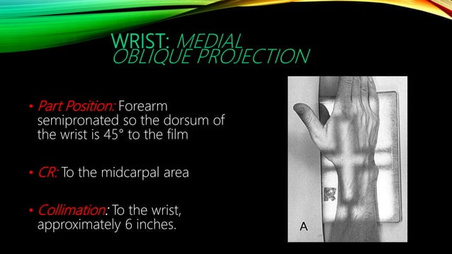 X ray of wrist and hand | PPTX