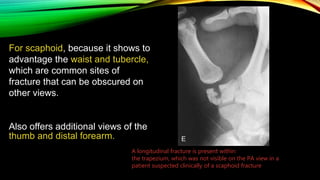 X ray of wrist and hand | PPTX