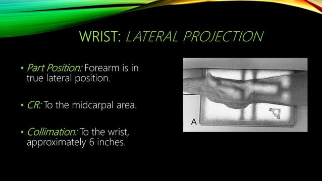 X ray of wrist and hand | PPTX