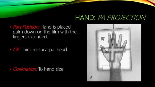 X ray of wrist and hand | PPTX
