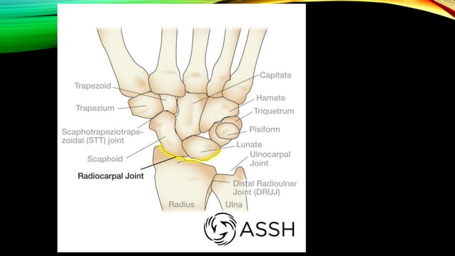 X ray of wrist and hand | PPTX