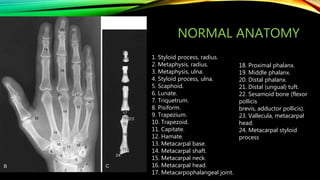 X ray of wrist and hand | PPTX