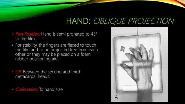 X ray of wrist and hand | PPTX