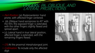 X ray of wrist and hand | PPTX