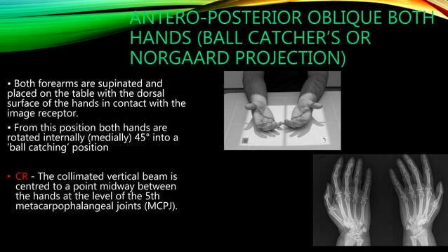 X ray of wrist and hand | PPTX