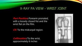 X ray of wrist and hand | PPTX