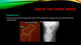X ray of wrist and hand | PPTX