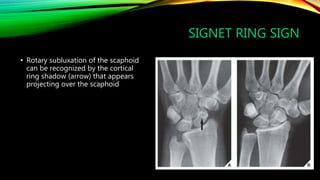 X ray of wrist and hand | PPTX