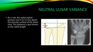 X ray of wrist and hand | PPTX