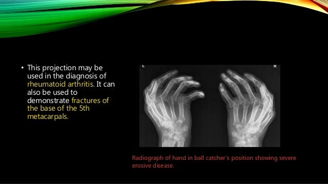 X ray of wrist and hand