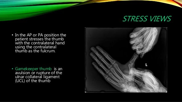 X ray of wrist and hand