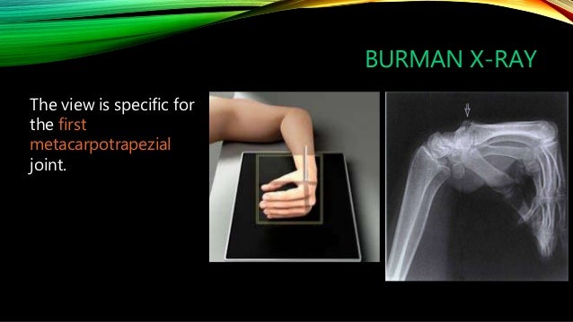 X ray of wrist and hand