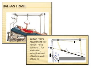 X-RAY , SPECIAL ORTHOPEDIC BEDS | PPTX