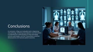 X-ray patterns of the Root Pathology.pptx