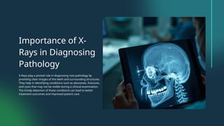 X-ray patterns of the Root Pathology.pptx