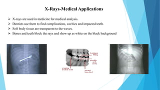 A presentation on X-Ray applications in various fields . | PPTX