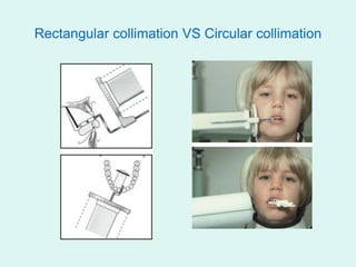 X ray pregnant 1 | PPT