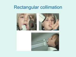 X ray pregnant 1 | PPT