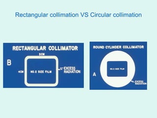 X ray pregnant 1 | PPT