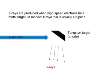X ray production 2 | PPT