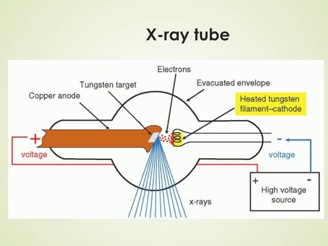 Physics of X-ray production by Dr. Aryan | PPT