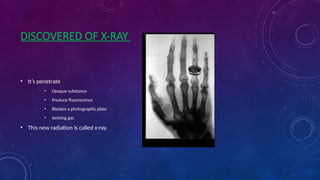 X-RAY PHYSICS AND IT'S PROPERTIES & FUNDAMENTALS FOR RADIOLOGY ...