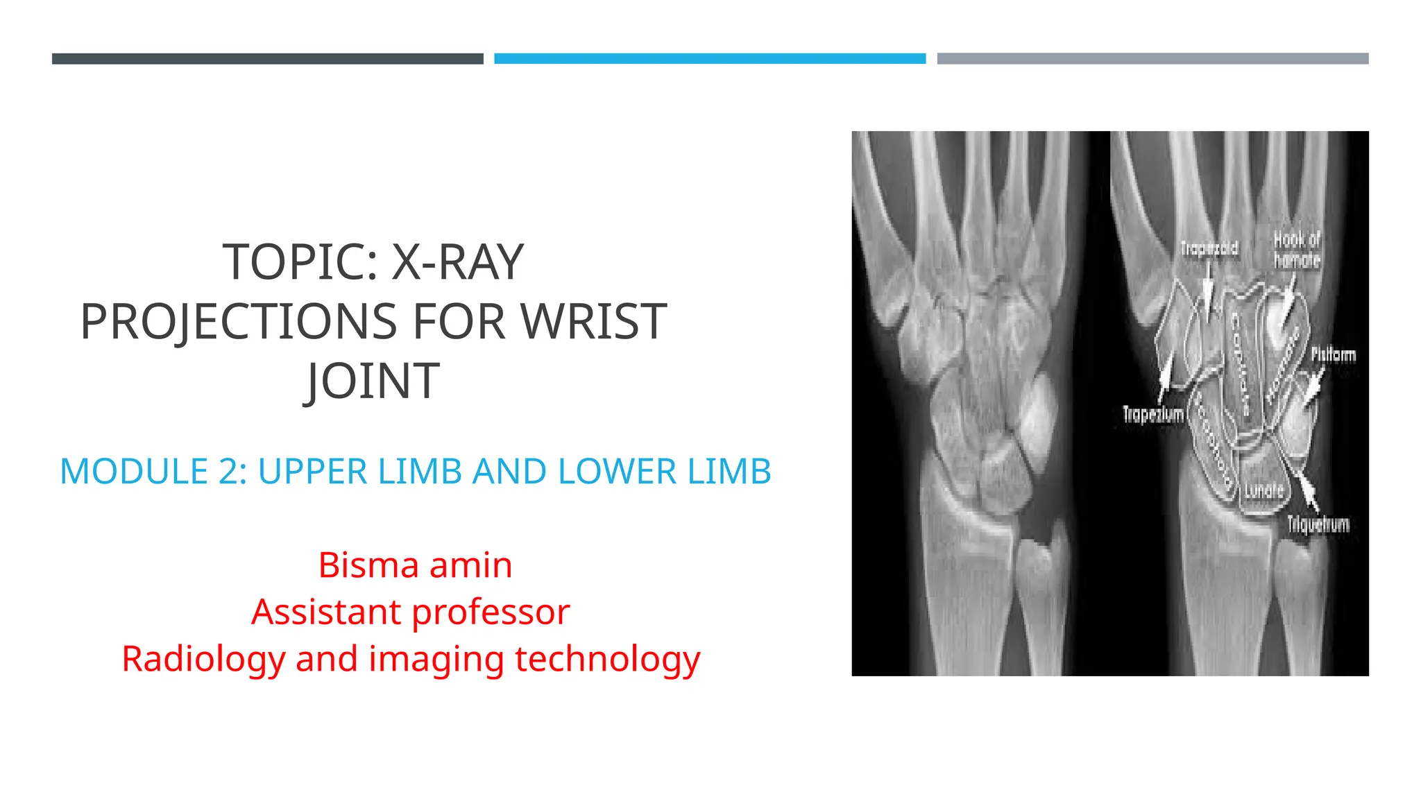 x-ray projections for wrist joint.pptx... | PPTX