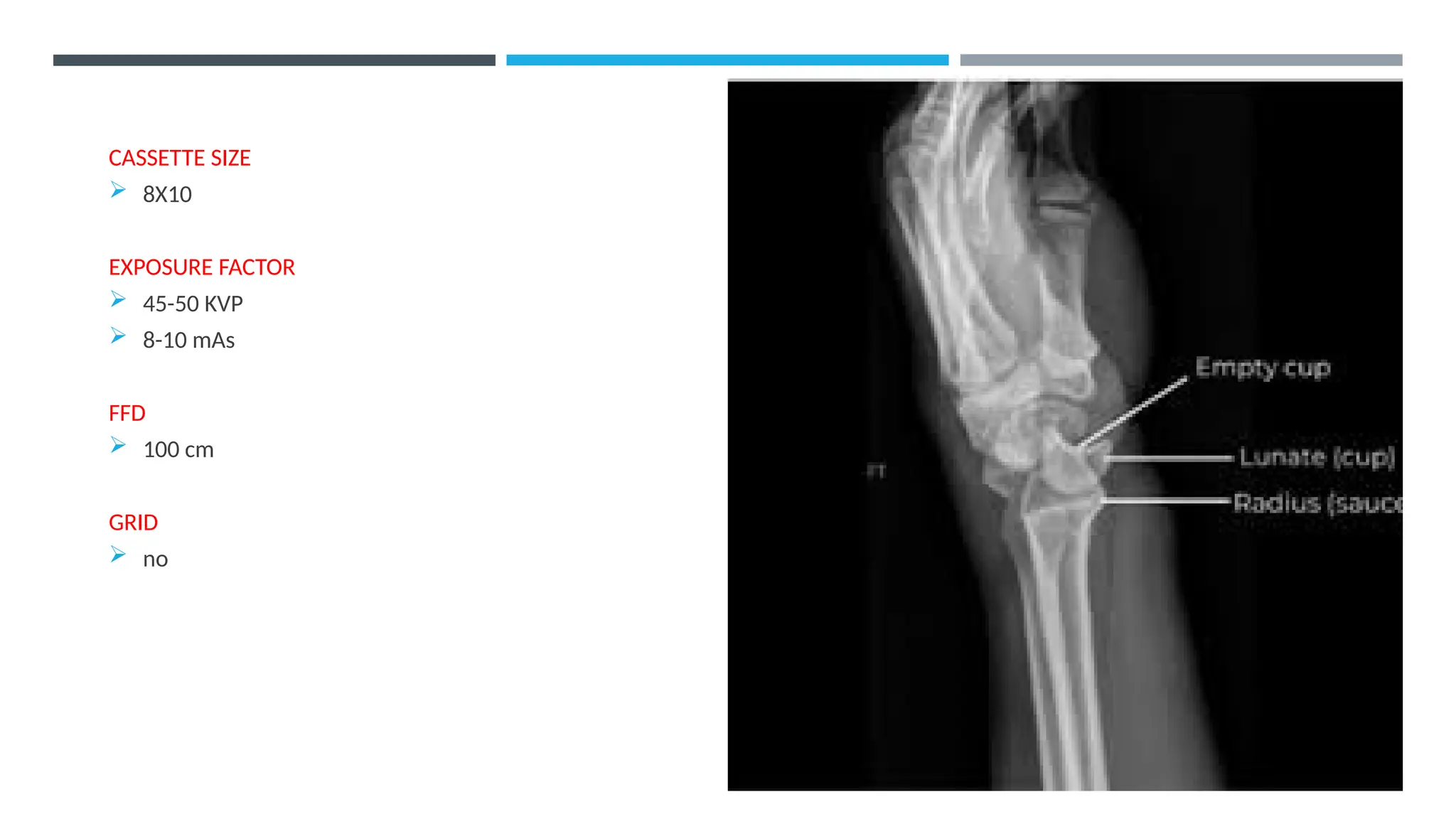 x-ray projections for wrist joint.pptx... | PPTX