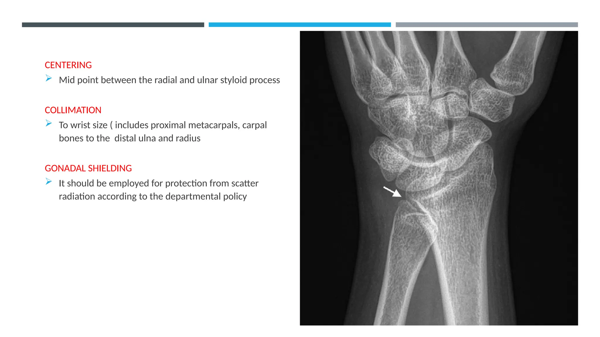 x-ray projections for wrist joint.pptx... | PPTX