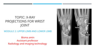 x-ray projections for wrist joint.pptx... | PPTX