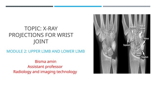 x-ray projections for wrist joint.pptx... | PPTX