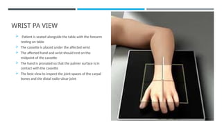 x-ray projections for wrist joint.pptx... | PPTX