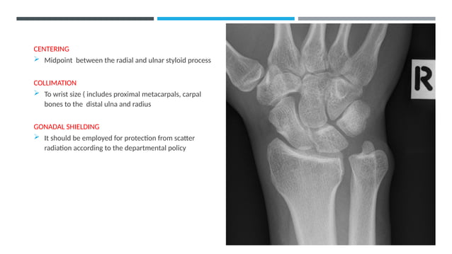 x-ray projections for wrist joint.pptx... | PPTX