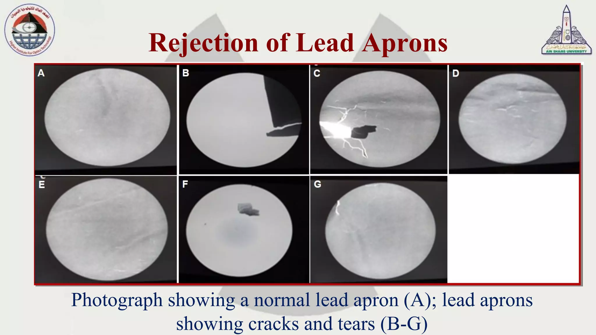 X ray protective aprons | PDF