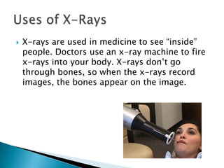 X-Rays | PPTX