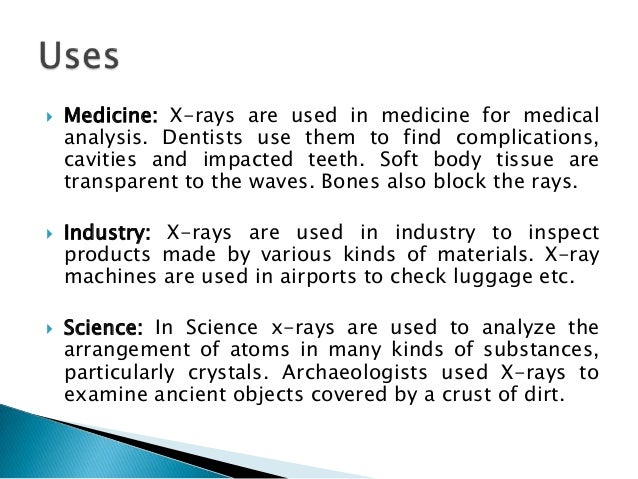 X Rays Uses