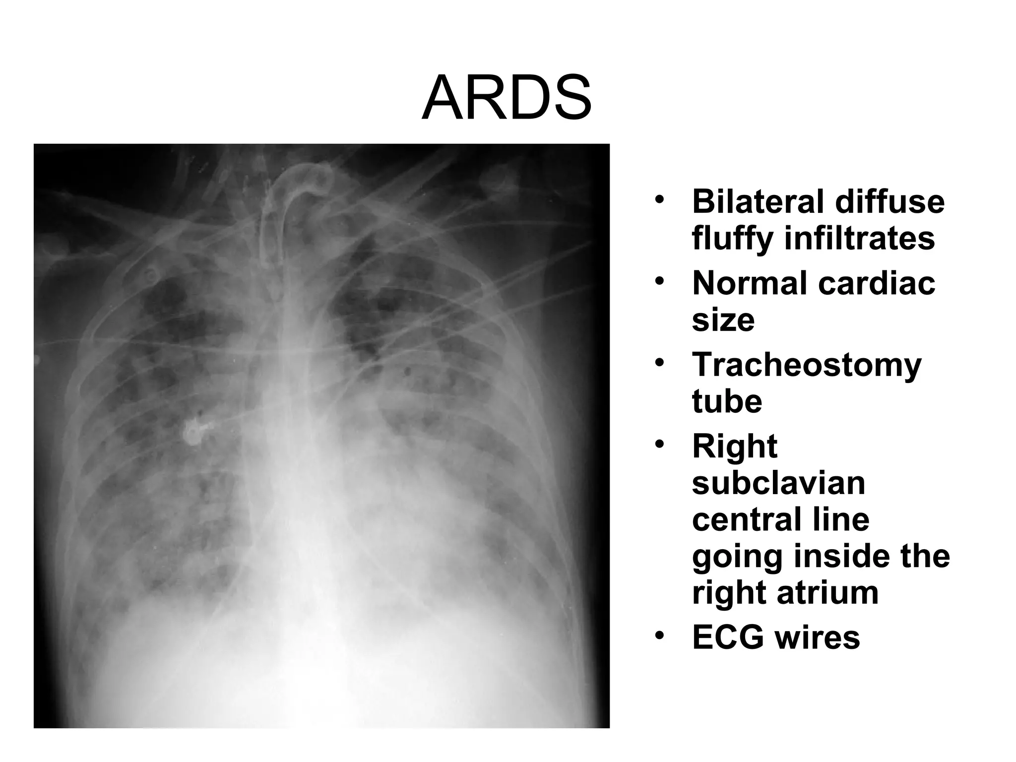 X rays | PPT