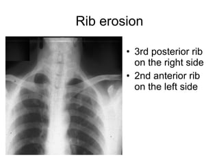 X rays | PPT