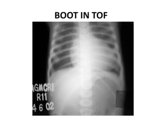 X rays- UG students - Dr. D. Gunasekaran, Professor of Pediatrics | PPTX