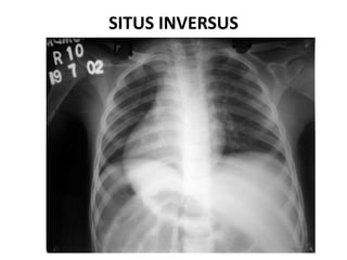 X rays- UG students - Dr. D. Gunasekaran, Professor of Pediatrics | PPTX