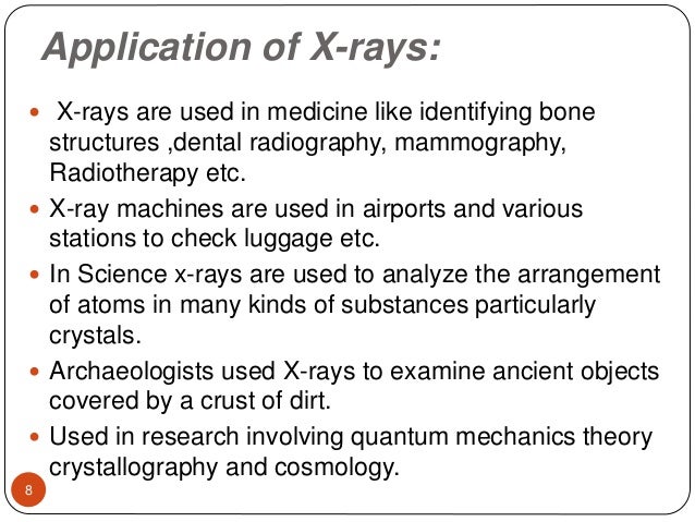Xrays Definition Of Xrays By Medical Dictionary