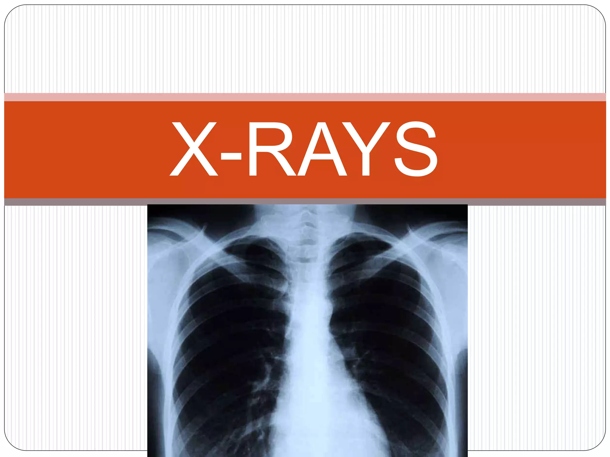X-RAYS | PPT