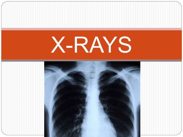 X-RAYS | PPT