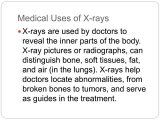 X-RAYS | PPT