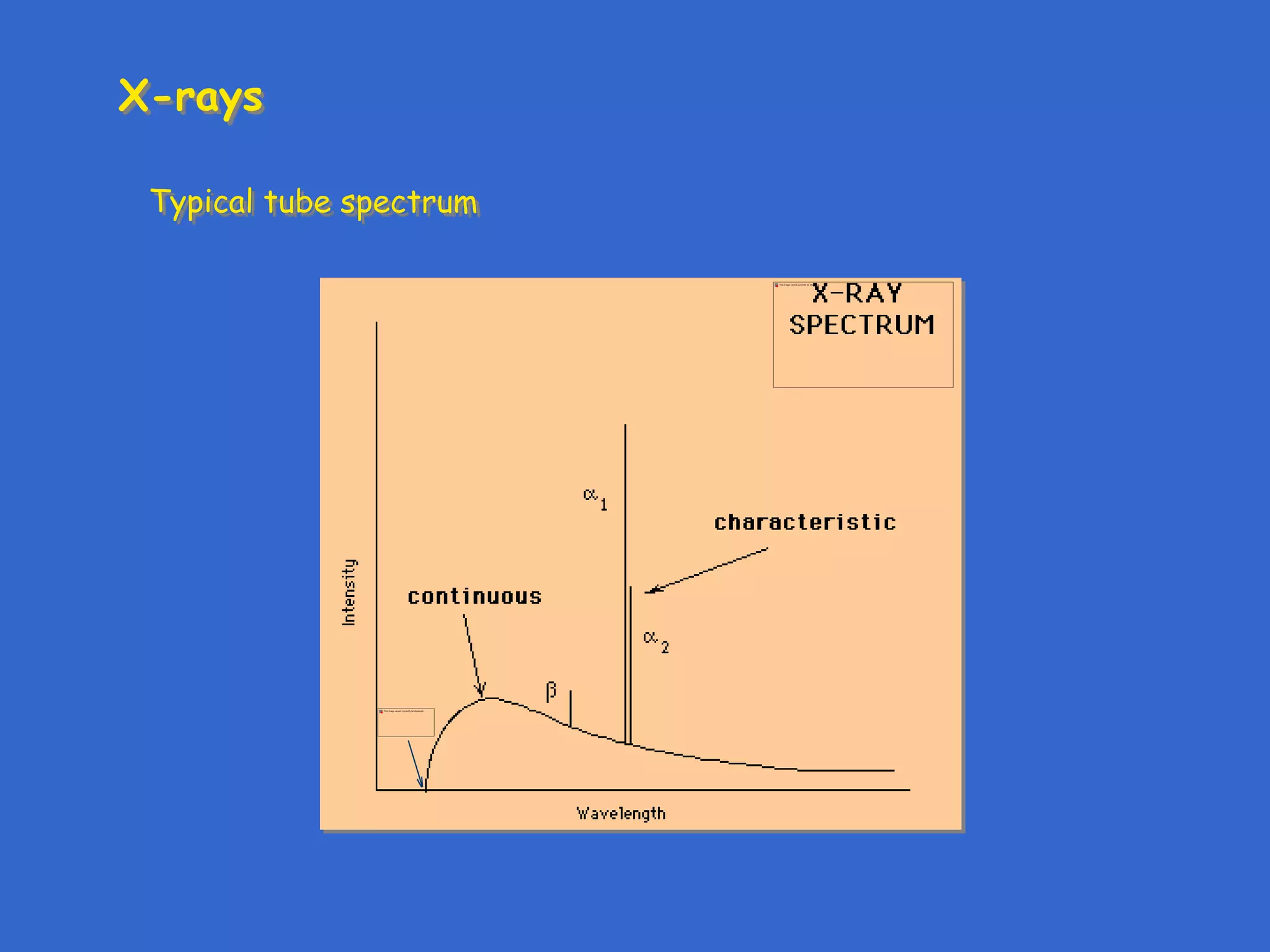 x-rays.ppt