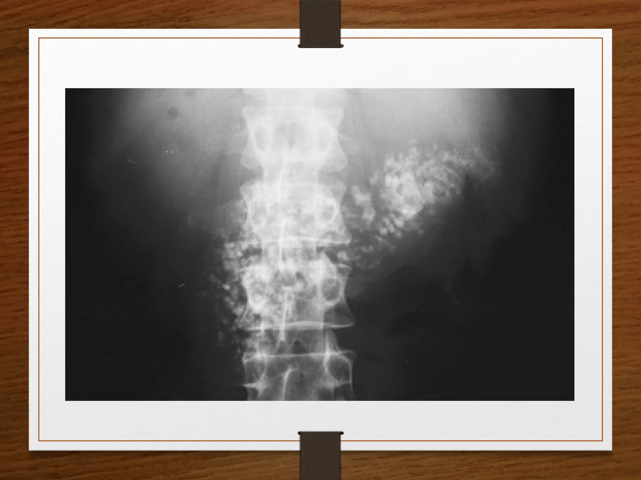 X-Rays.pptx egfhgfegfgefgfigfriegiuergrg | PPT