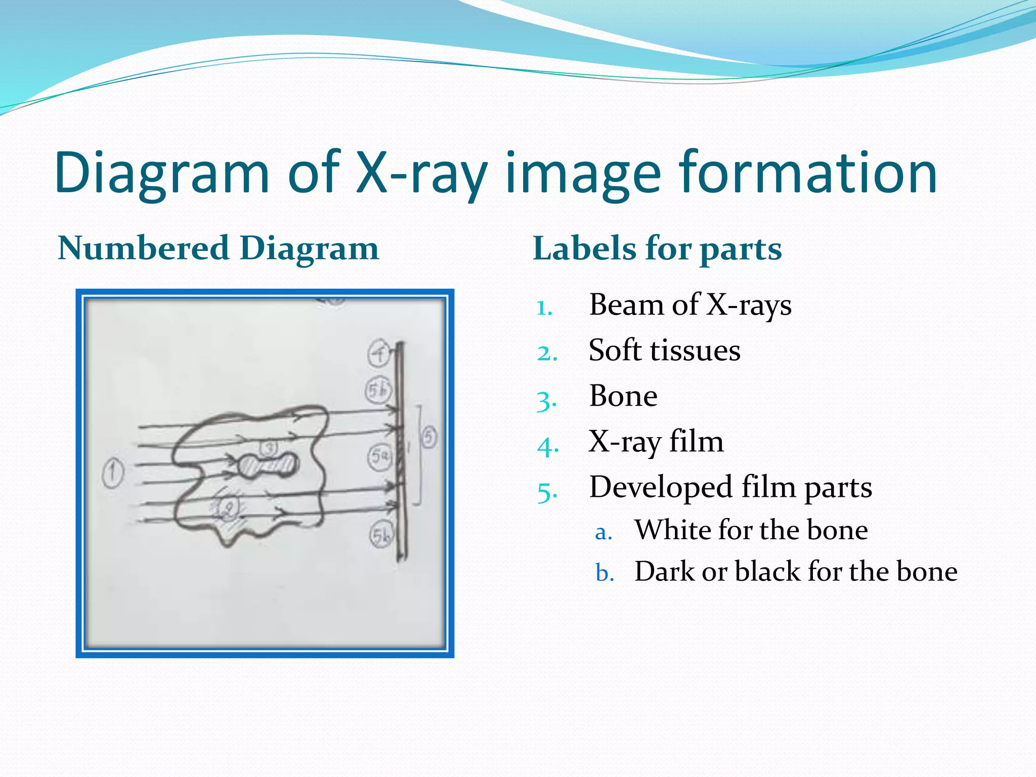 X-Rays and their Medical Use.pptx | Medical Tests | Medical Health